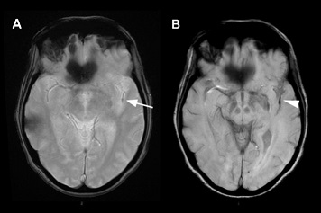 Haute Autorité de Santé - Place de l'imagerie dans la prise en charge ...