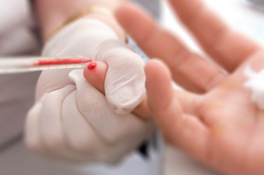 Haute Autorité de Santé - Dépistage de l’hépatite B : des tests rapides ...