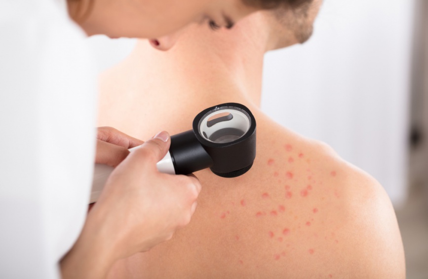 Haute Autorité de Santé - Prise en charge des infections cutanées ...